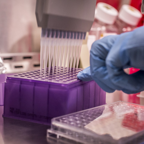 Saad pioneering HIV research with an R37 MERIT Award - Heersink School ...