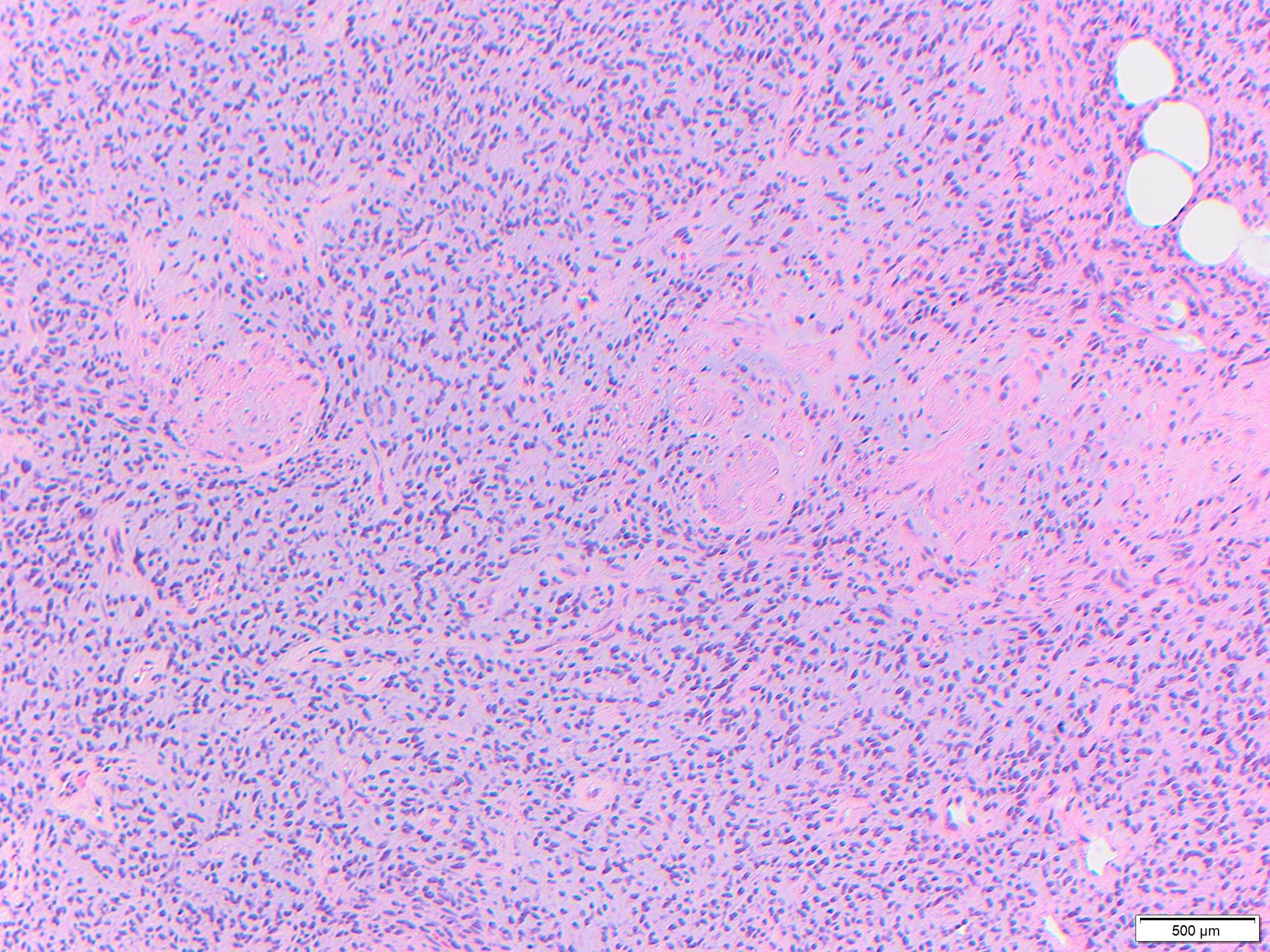 August 16 2021 Pathology UAB August 16 2021 Pathology UAB