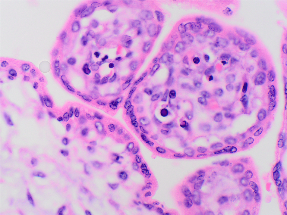 July 6, 2020, Week 1 - Pathology