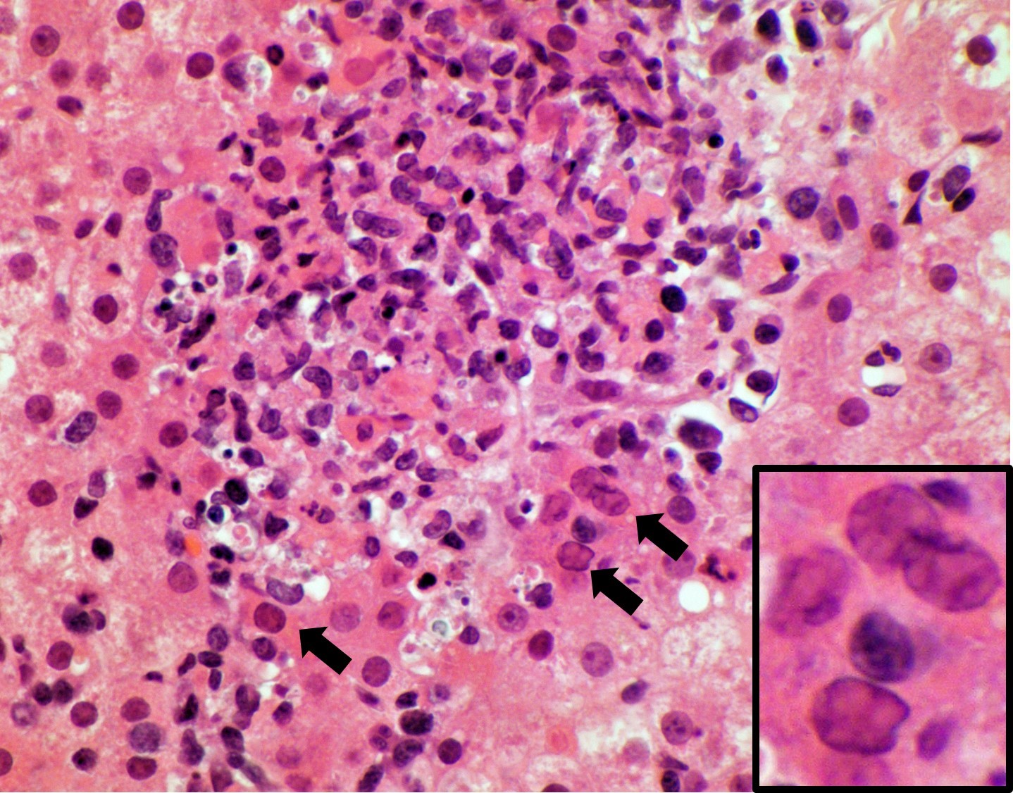 August 24, 2020, Week 4 - Pathology