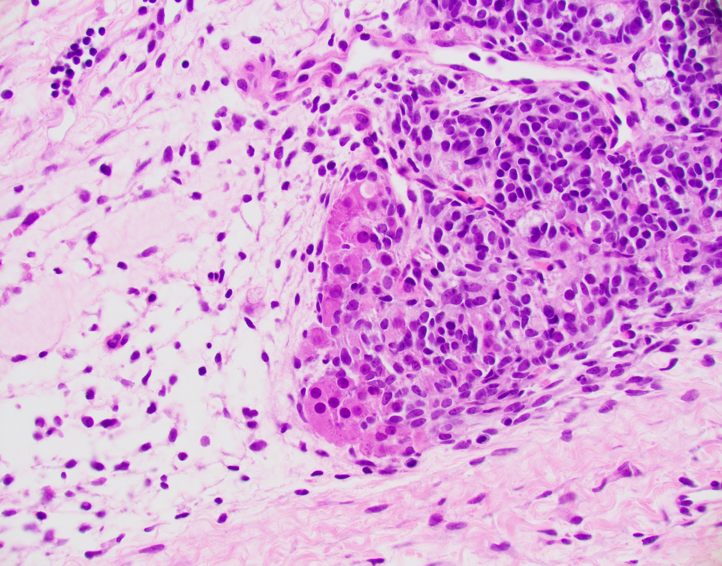 2020 Archived Case of the Week | Pathology