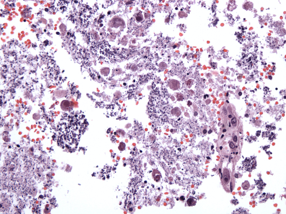 Case of the Week - School of Medicine - Pathology | UAB