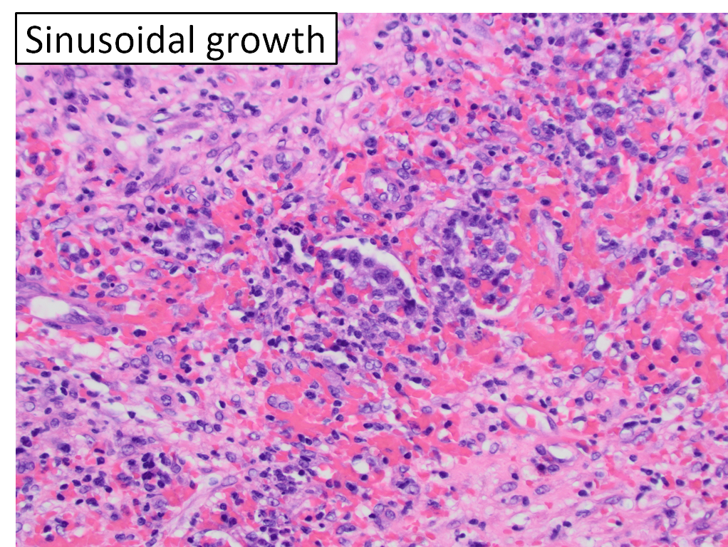 August 10, 2020, Week 2 - Pathology