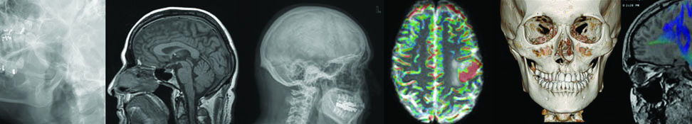 UAB - Department of Radiology - Neuroradiology Fellowship Program